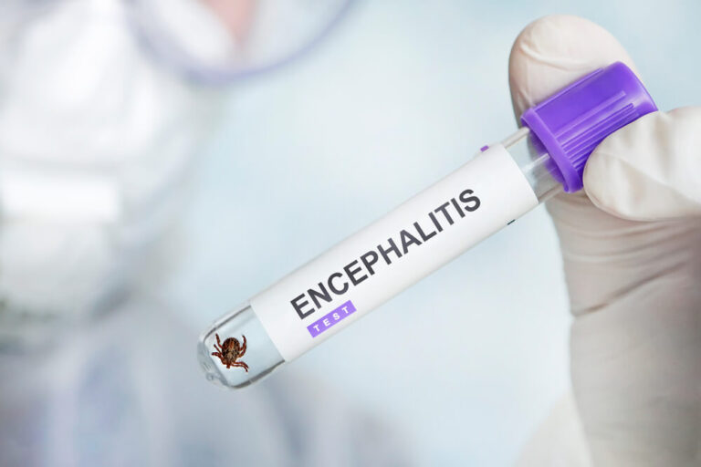 Encefalite viral: sintomas, causas e tratamento alternativo com CBD