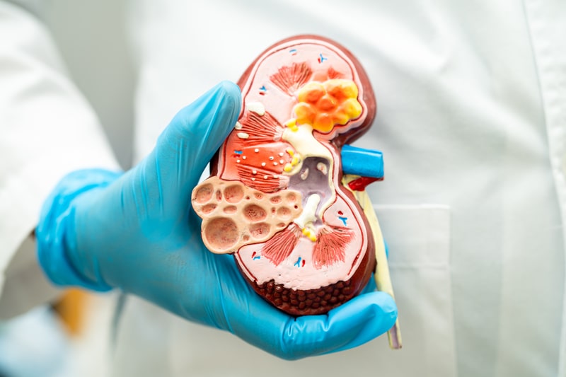 Dores nos rins: O que pode provocar, Como aliviar e Tratar